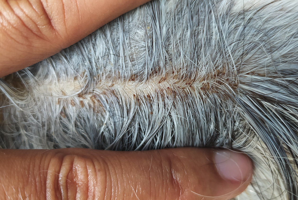 Common horse skin conditions shown in pictures - Your Horse