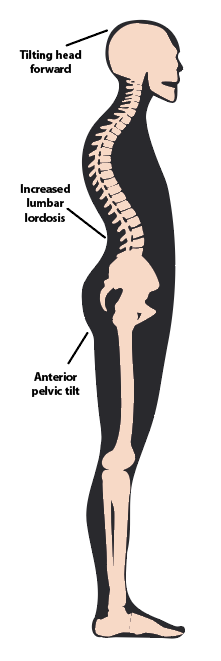 Rider posture: common muscles that may be compromised and affecting ...